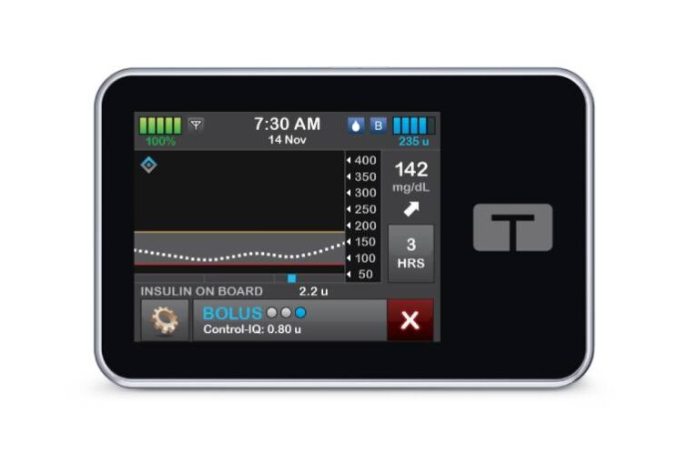 Tandem delivers more options, benefits for those with diabetes